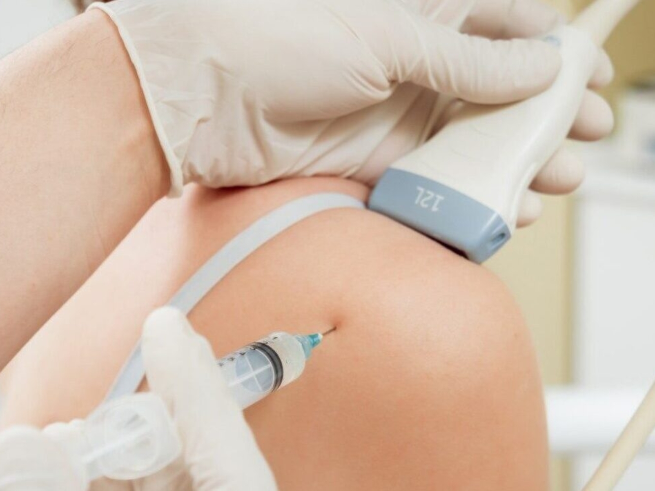 Steroid Injection for Shoulder Pain: What You Should Know